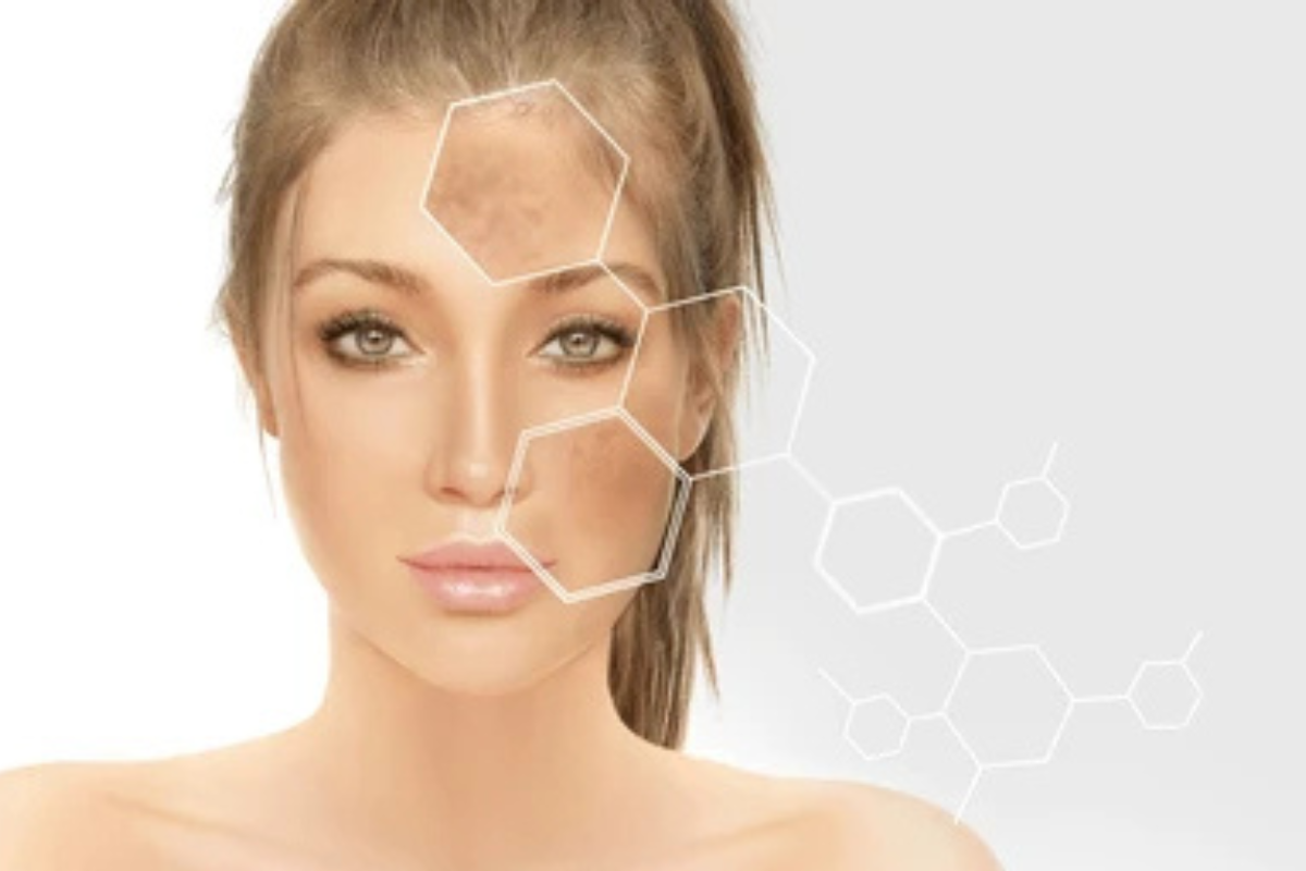 PIH - Dr Vrushali Shinde | Best Aesthetic Skin Clinic